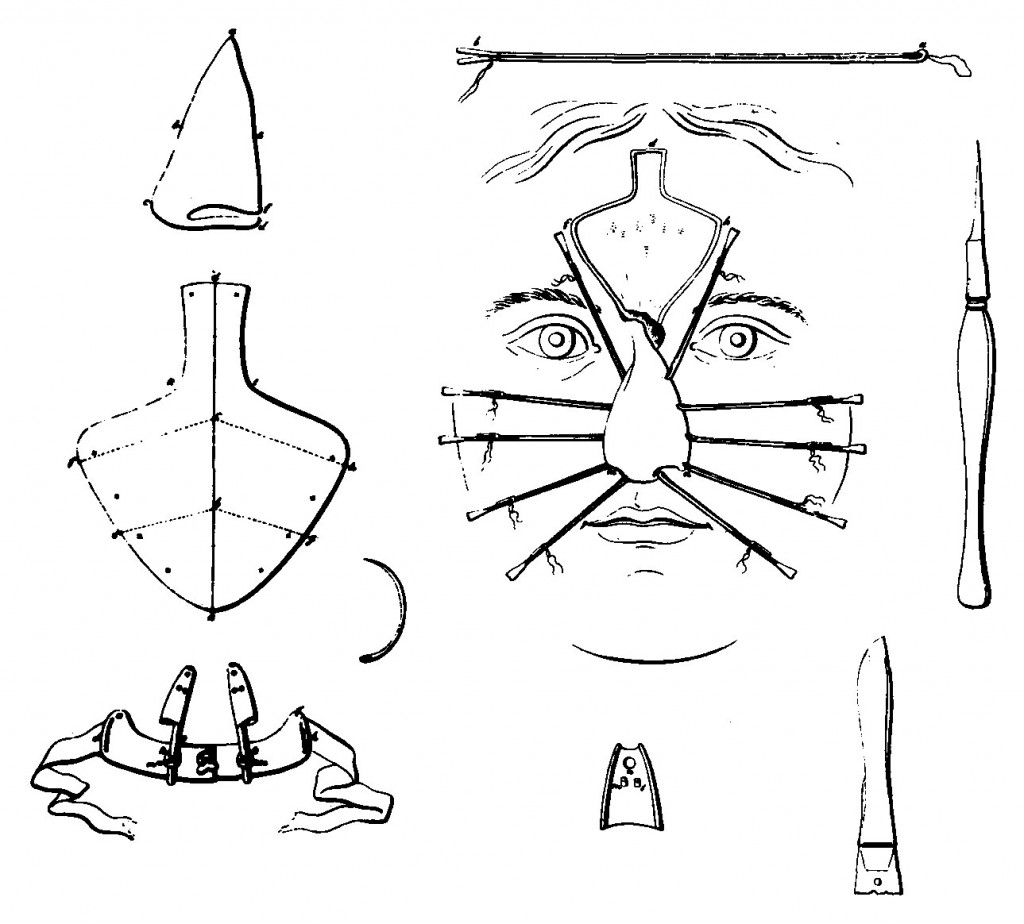 The Impact of Indian Methods for Total Nasal Reconstruction – Larry S ...